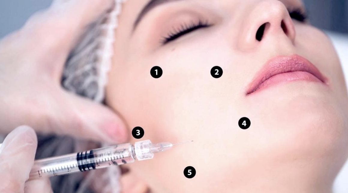 PROFHILO : Bio-Remodeling & Anti Aging - E3A Clinic