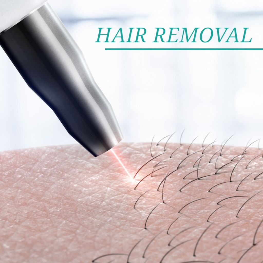 LASER HAIR REMOVAL: Hilangkan Rambut Yang Tidak Diinginkan - E3A Clinic