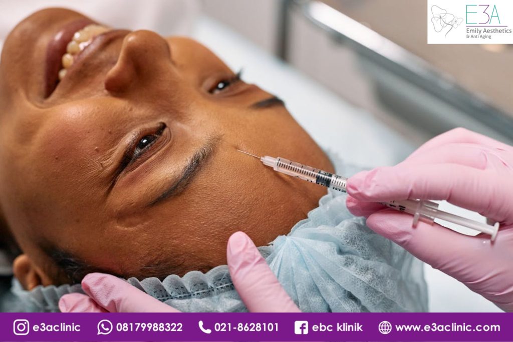 5 Manfaat Perawatan Botox dalam Dunia Kecantikan dan Medis - E3A Clinic